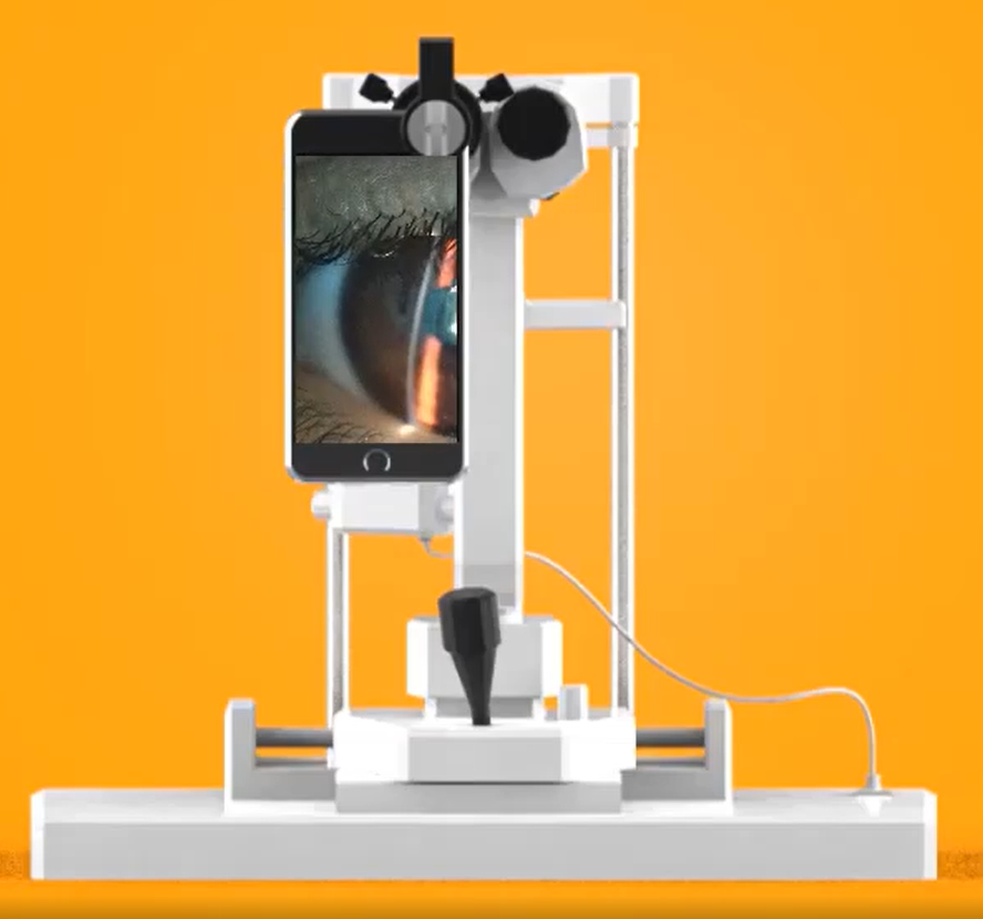 Venous Loop: What is it?! - Ophthalmology Education