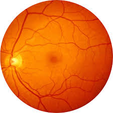 What is Geographic atrophy? answer inside Ophthalmology Education